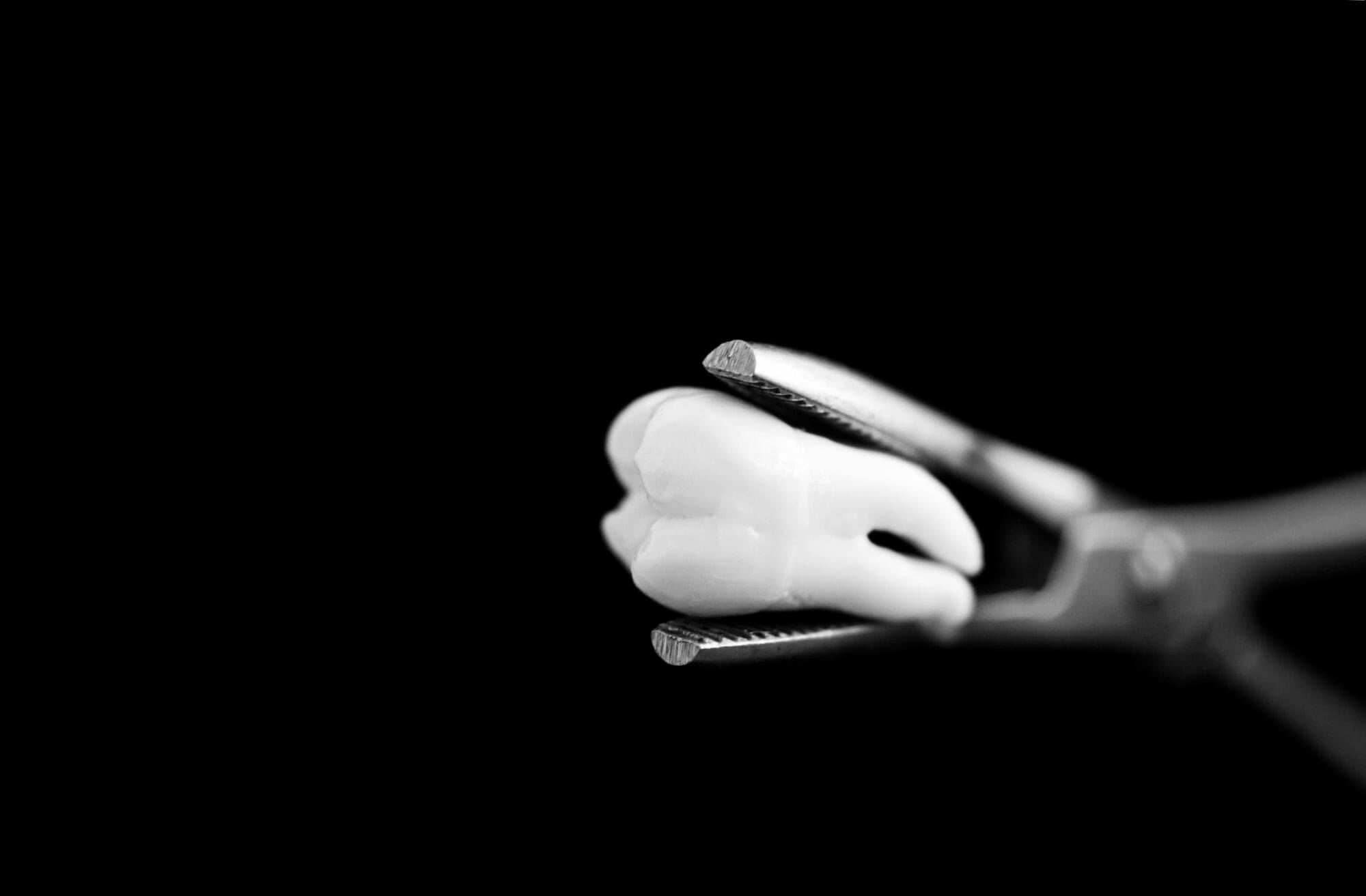 Learn What To Expect When Having a Tooth Extracted