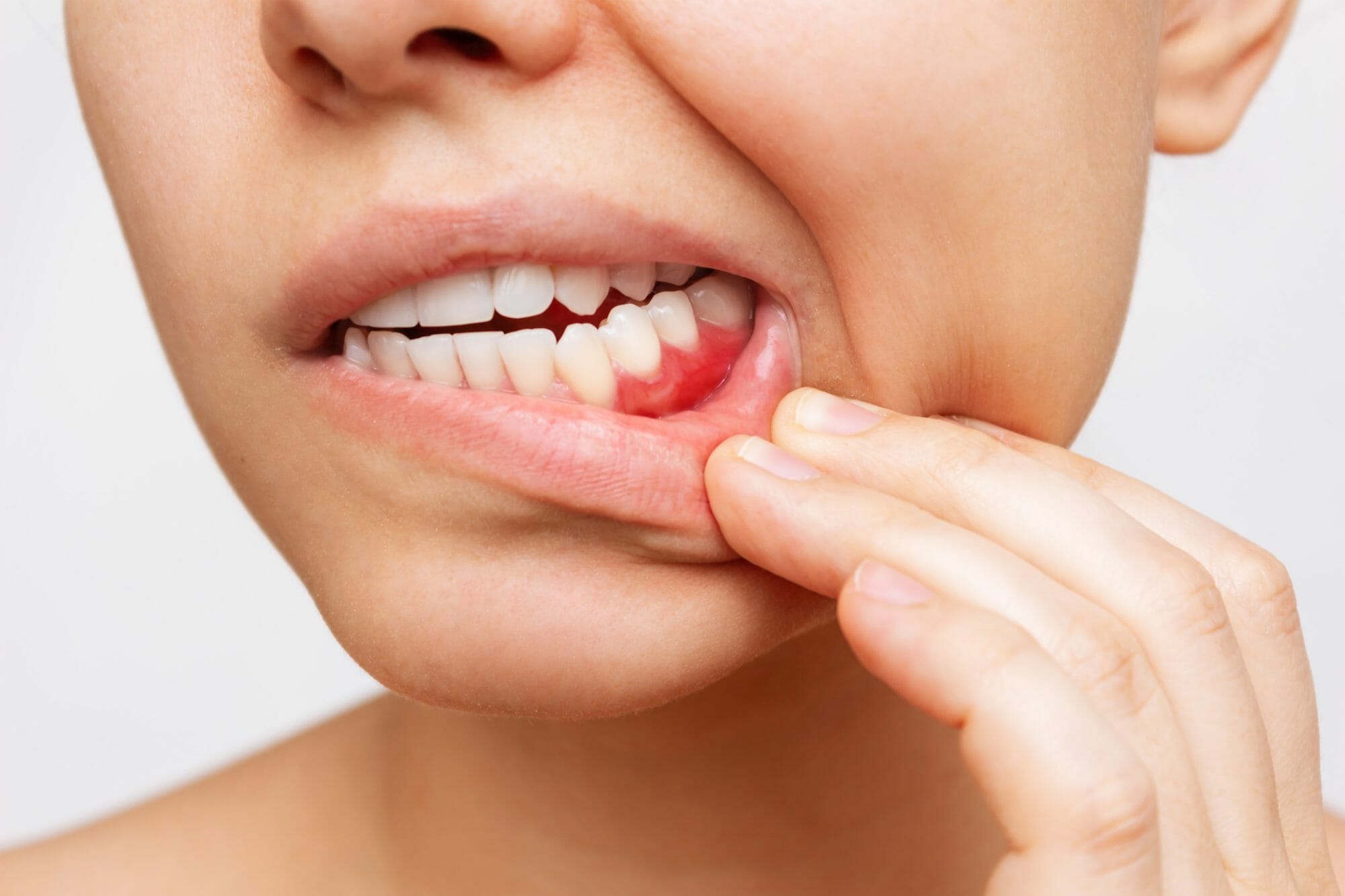 Learn The Dangers of Untreated Periodontal Disease